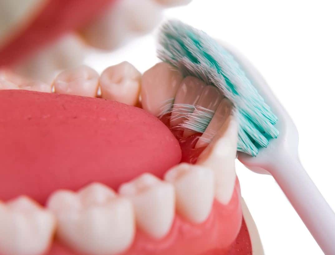 How to Fix Cavities Between Teeth: The Best 4 Easy Steps Way